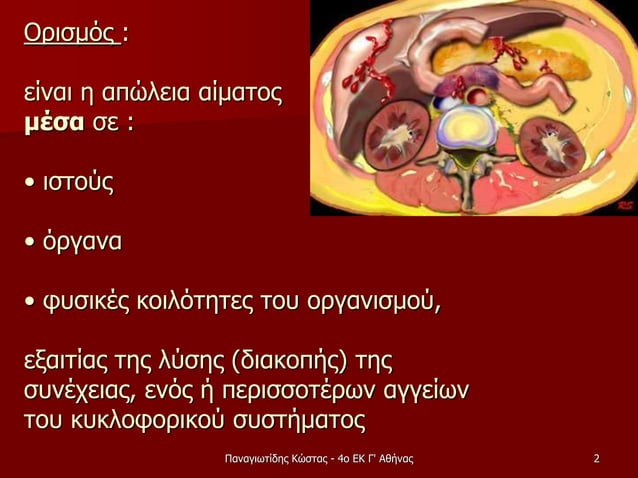 6β. ΑΙΜΟΡΡΑΓΙΕΣ: ΕΣΩΤΕΡΙΚΗ ΑΙΜΟΡΡΑΓΙΑ | PPT