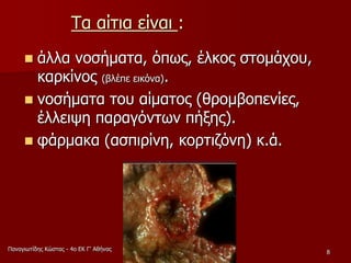 6β. ΑΙΜΟΡΡΑΓΙΕΣ: ΕΣΩΤΕΡΙΚΗ ΑΙΜΟΡΡΑΓΙΑ | PPT