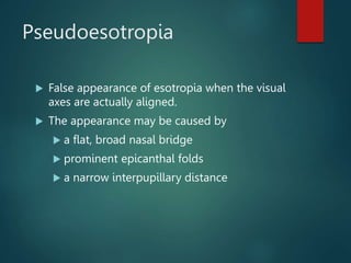 Esotropia ophthalmology presentation HSAH.pptx