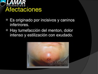 Espacios aponeuroticos | PDF