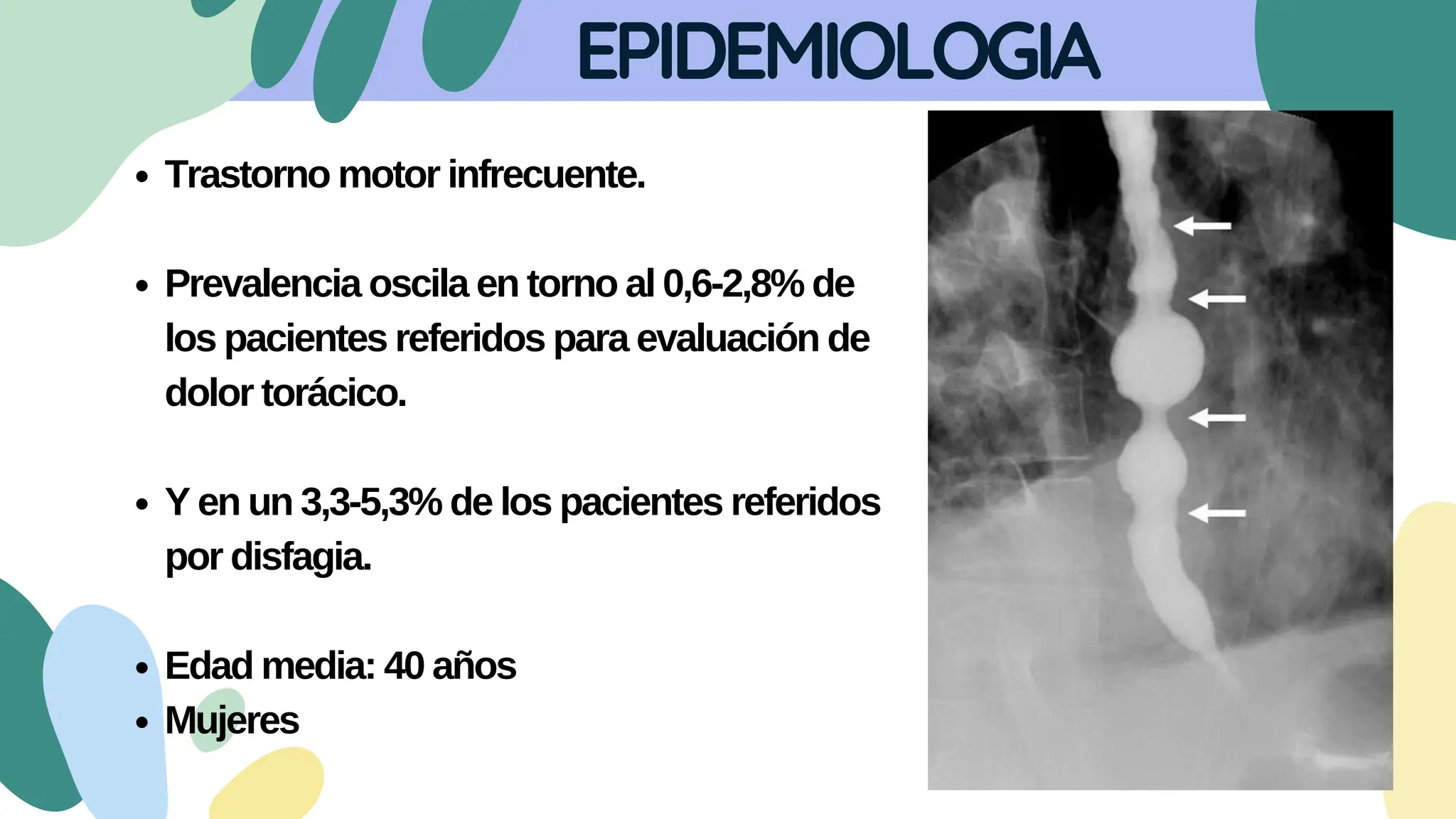 Espasmo esofagico difuso Gastroenterologia.pdf