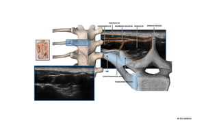 ESP block | PDF