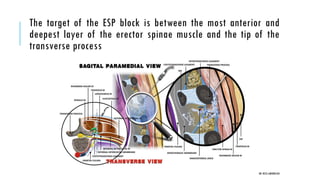 ESP block | PDF