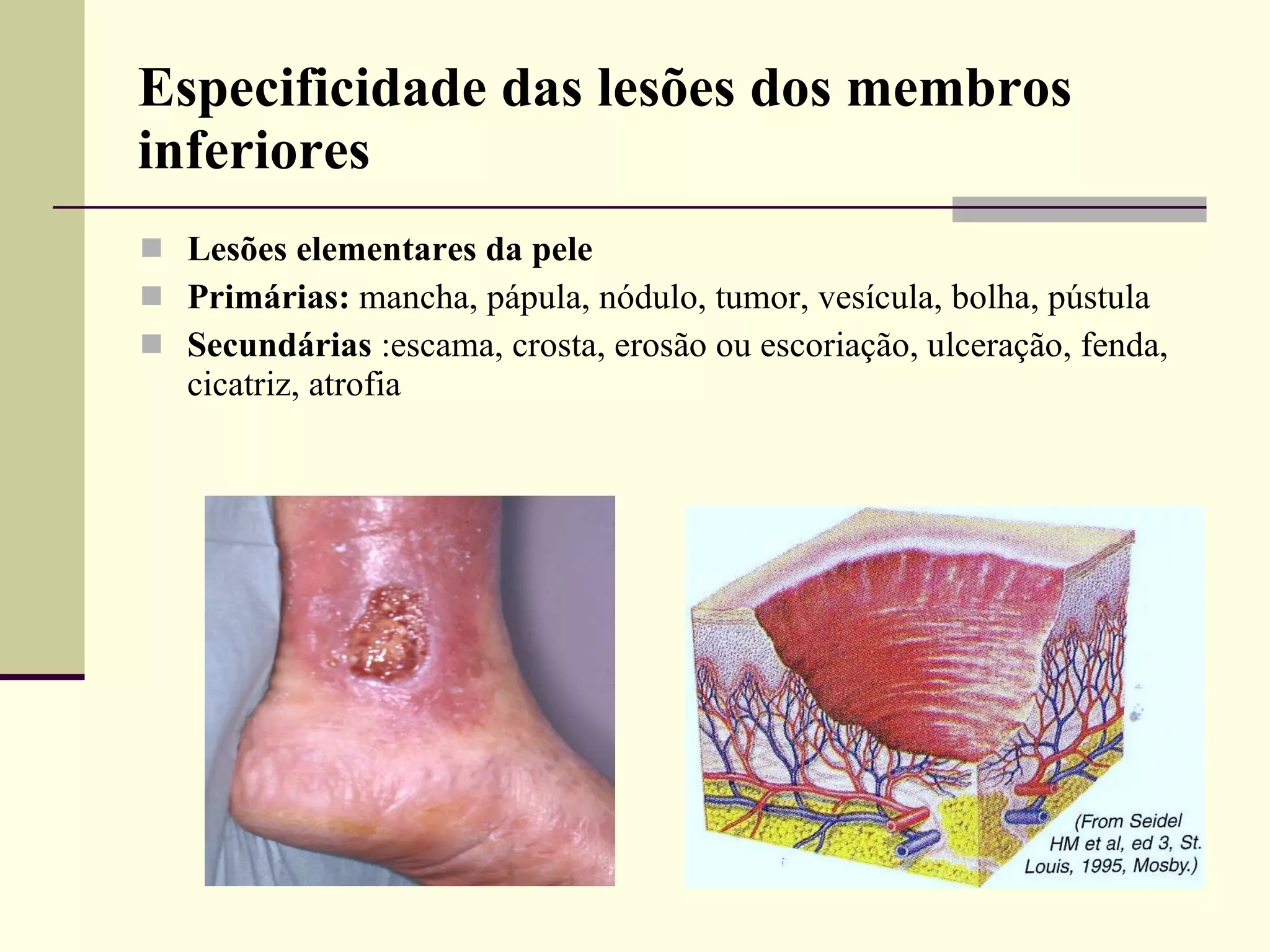 Especificidade das lesões dos membros inferiores elcos cova beira 2010 ...