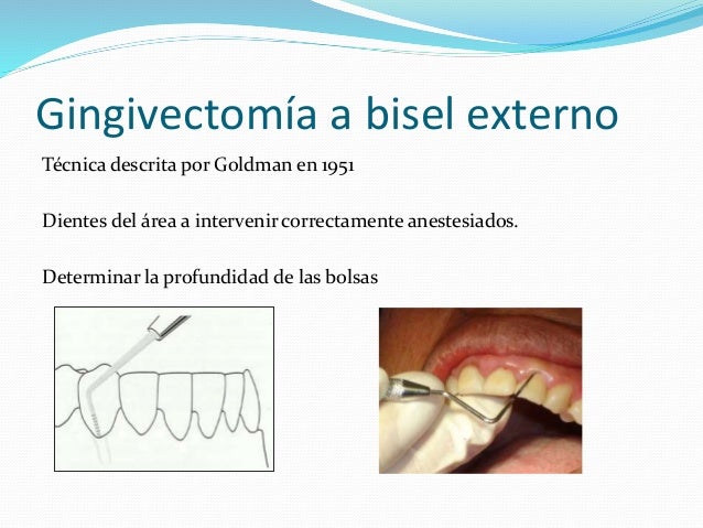 Espesor biológico, gingivectomía, bisel interno, bisel externo, alarg…