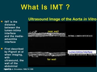 Espessamento medio intimal carótidal trials | PPT