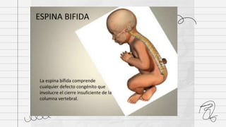 ESPINA BIFIDA | PPTX