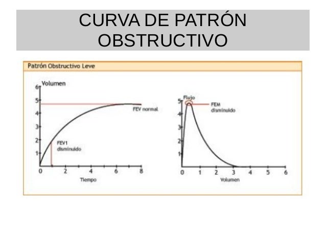 Espirometria Forzada en Atención Primaria