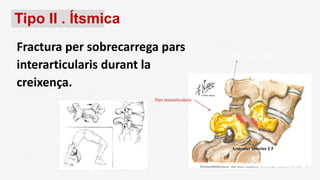 ESPONDILOLISIS ESPONDILOLISTESIS 1234.pdf
