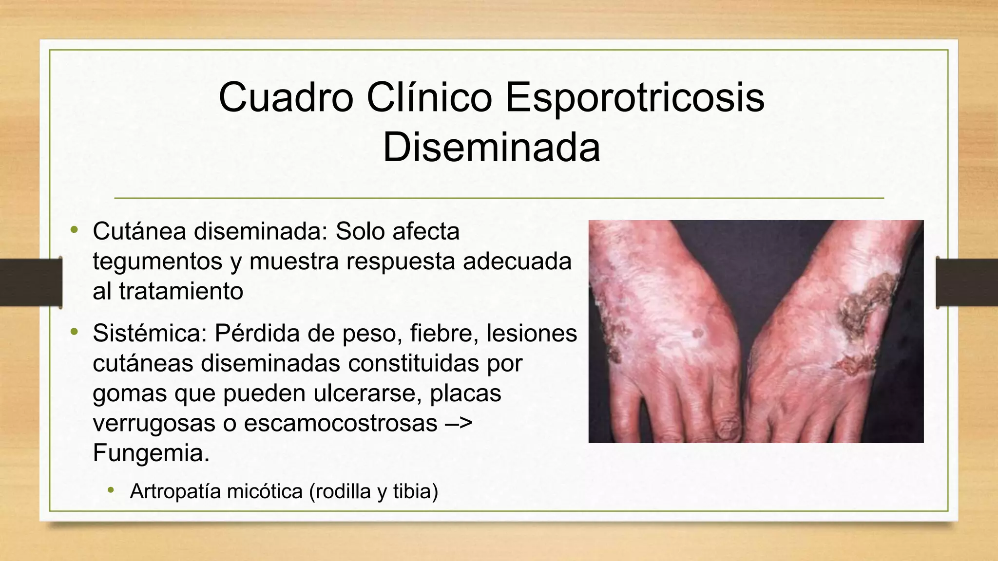Esporotricosis dermatología | PPTX
