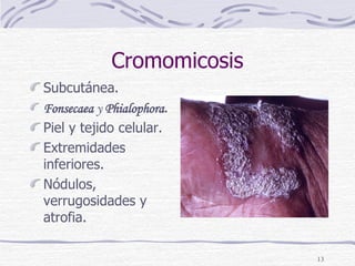 Esporotricosis Y Cromomicosis | PPT
