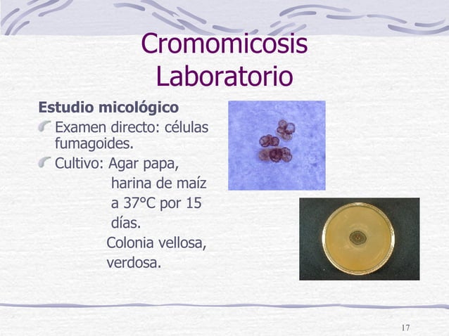 Esporotricosis Y Cromomicosis | PPT
