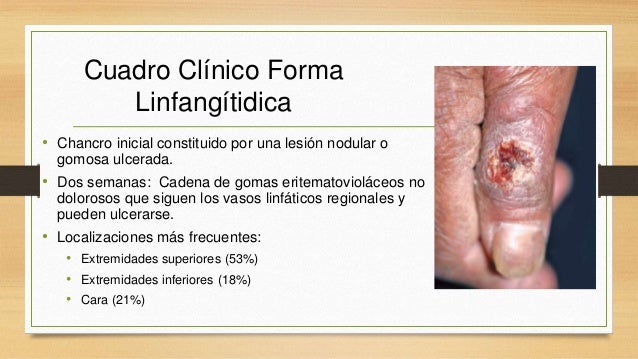Esporotricosis dermatología