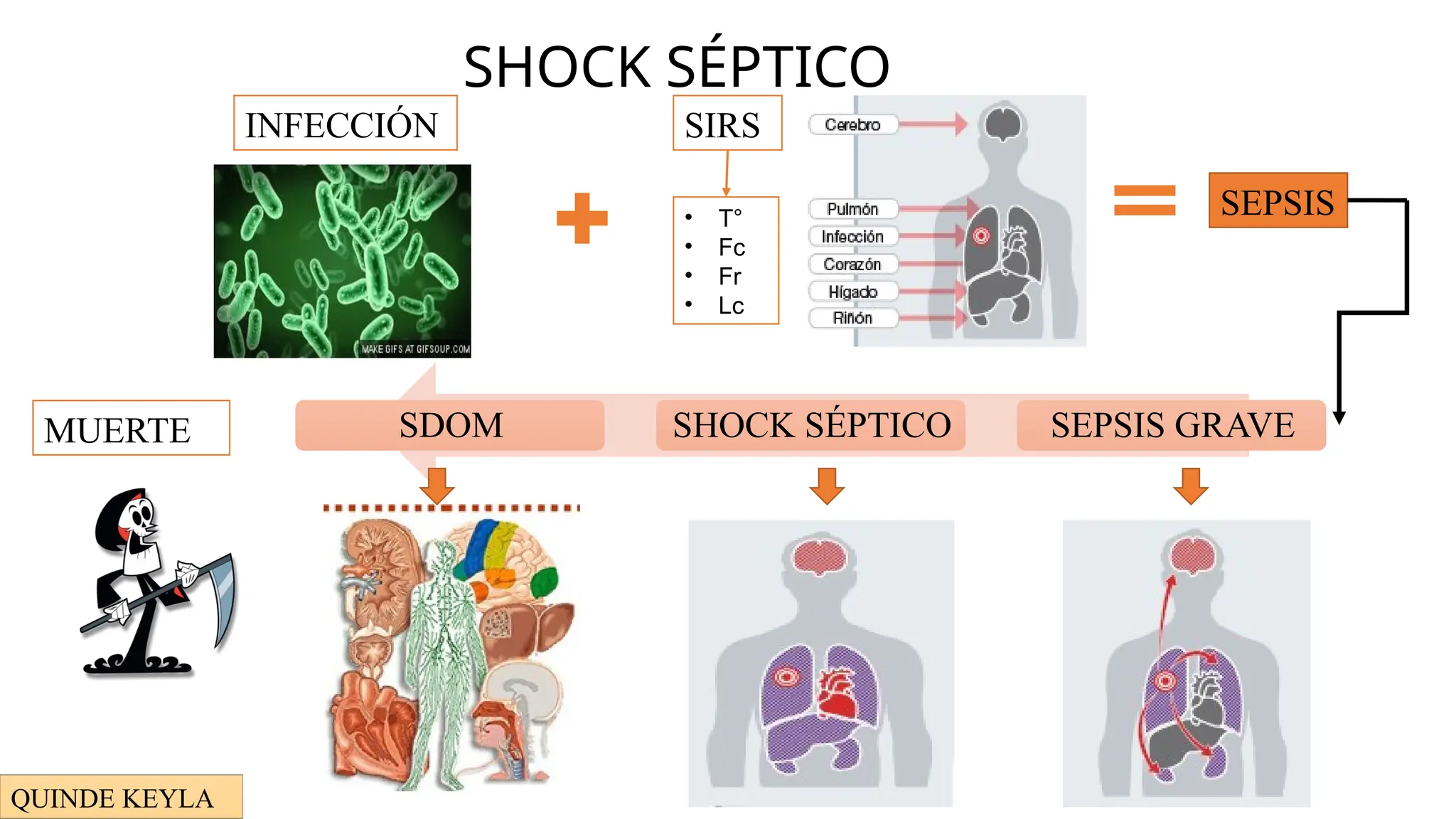 enfermeria ESPOSICION_DE_SHOCK_SEPTICO.pptx
