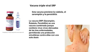 esquema de vacunas pediatra... 2025 HDL. | PPTX