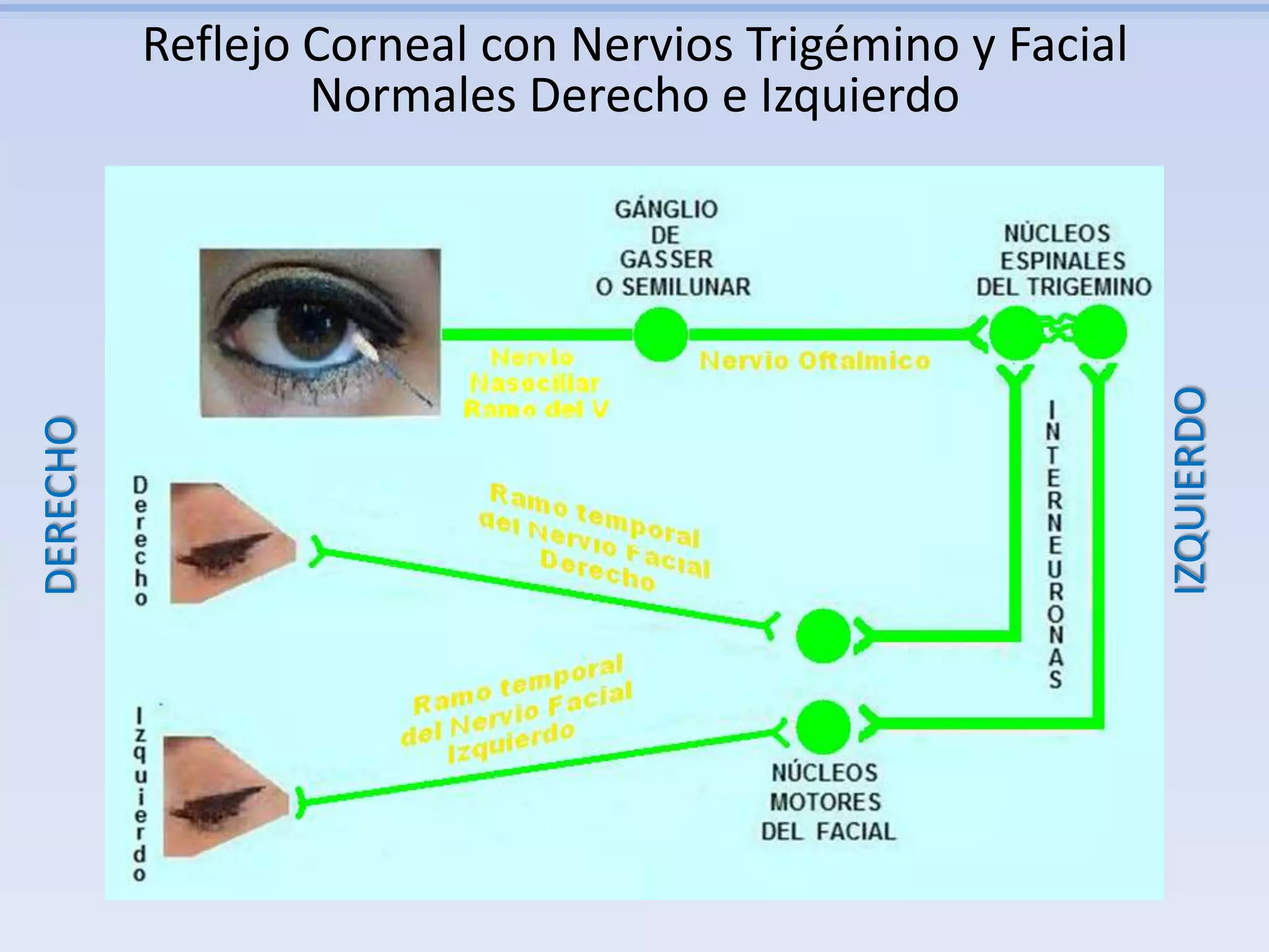 Esquema del reflexo corneal | PPSX