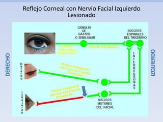 Esquema del reflexo corneal | PPSX