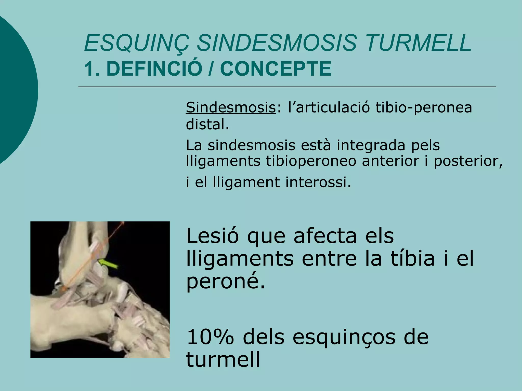 Esquinç sindesmosis turmell | PPT