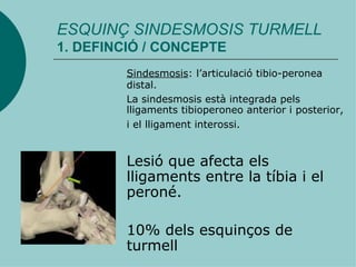 Esquinç sindesmosis turmell | PPT