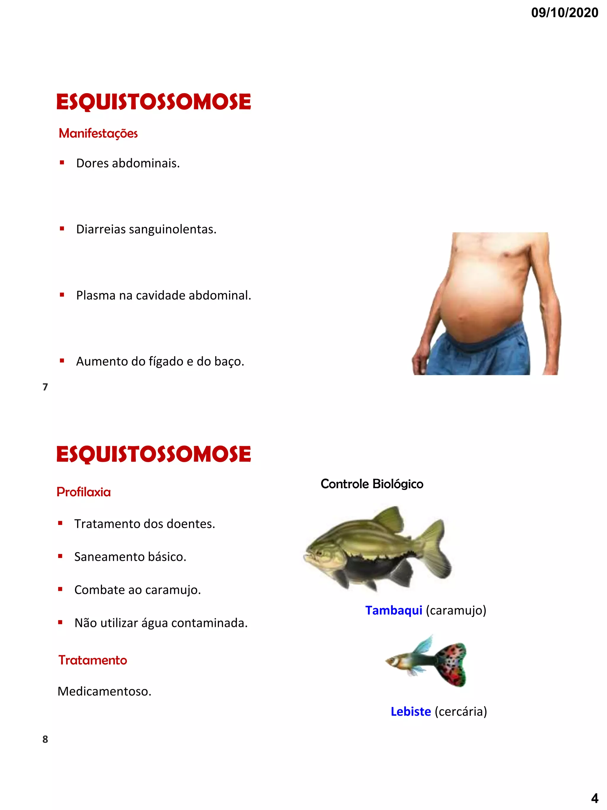 ESQUISTOSSOMOSE.pdf