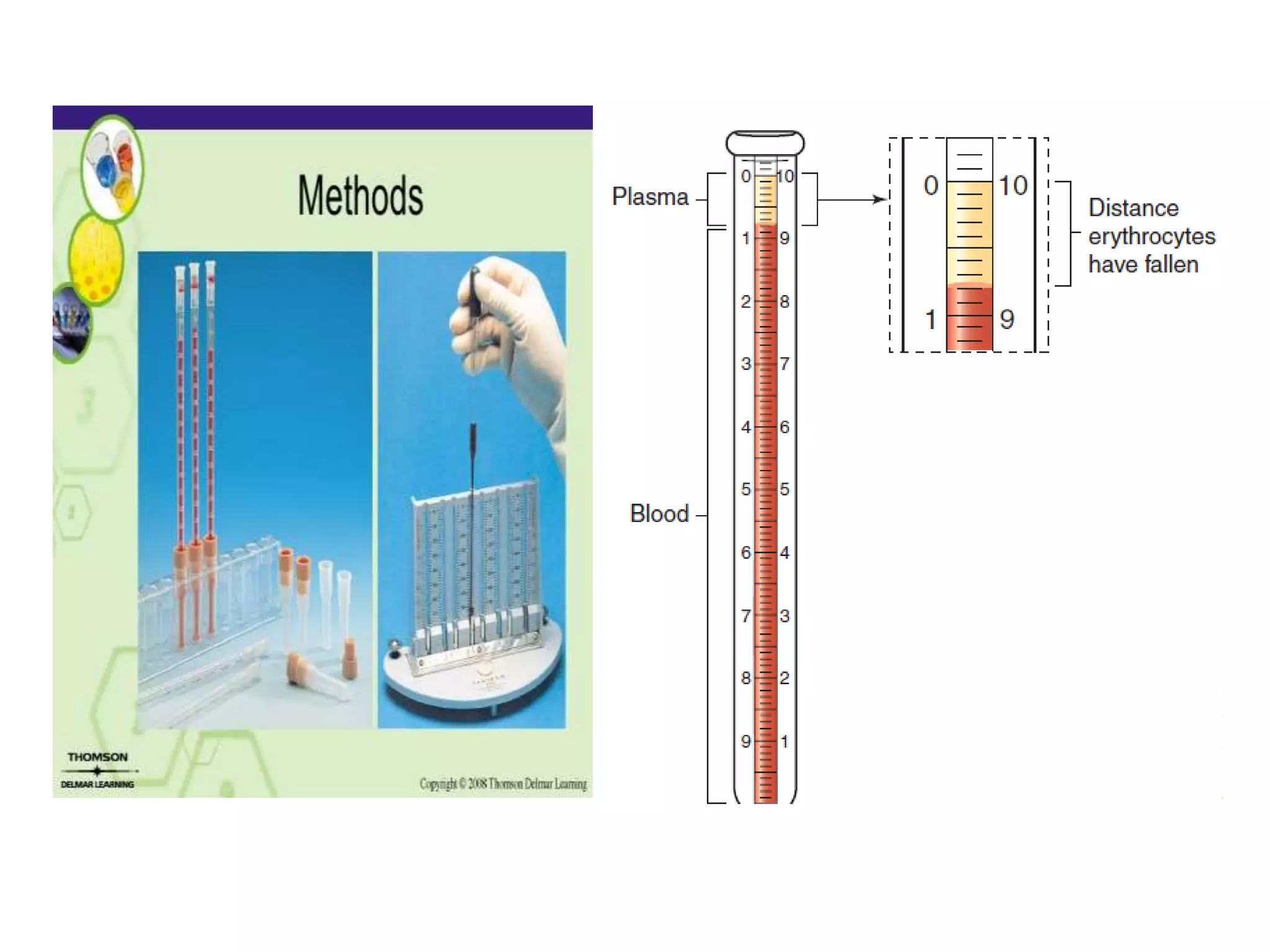 Erythrocyte Sedimentation Rate | PPTX
