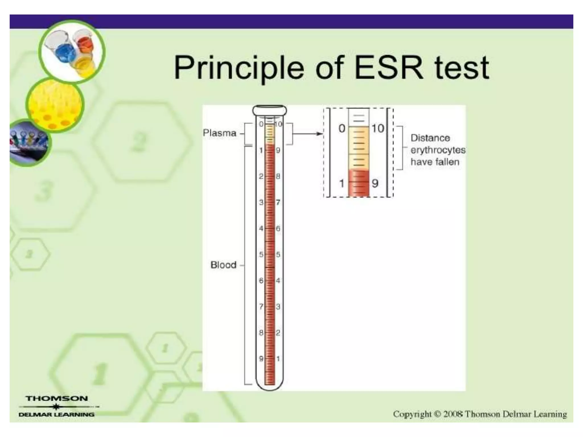 Erythrocyte Sedimentation Rate | PPTX