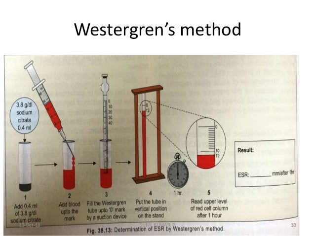 Erythrocyte Sedimentation Rate (ESR)