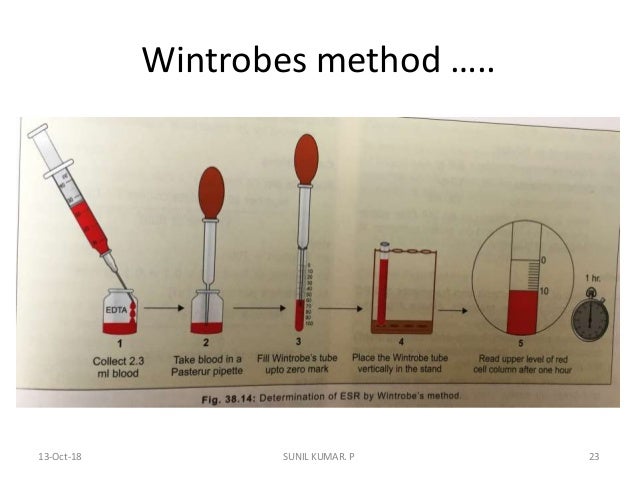 Erythrocyte Sedimentation Rate (ESR)