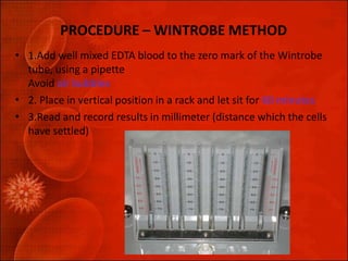 ESR.pptx | Blood Disorders | Diseases and Conditions