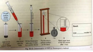 erythrocyte sedimentation rate(ESR) .pptx