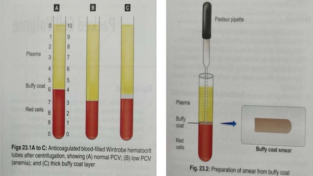 erythrocyte sedimentation rate(ESR) .pptx