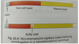 erythrocyte sedimentation rate(ESR) .pptx
