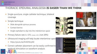 Thoracic Epidural Analgesia for Major Open Abdominal Surgery | PPTX