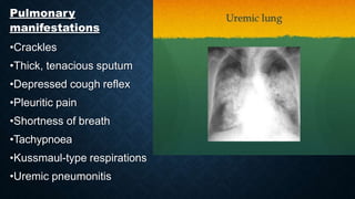 esrd-200430175414.pptx