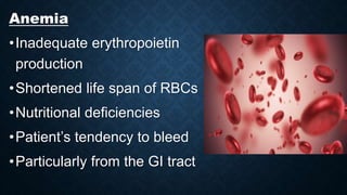 End stage renal disease and its management | PPTX