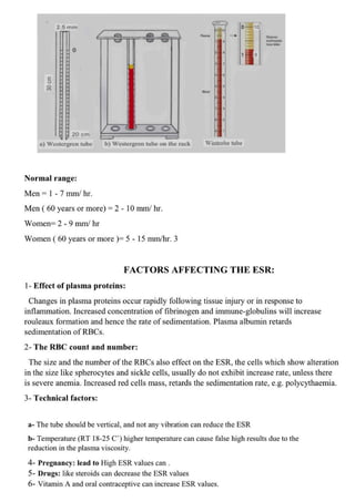 ESR Test practical hematology lab ( free download) | PDF