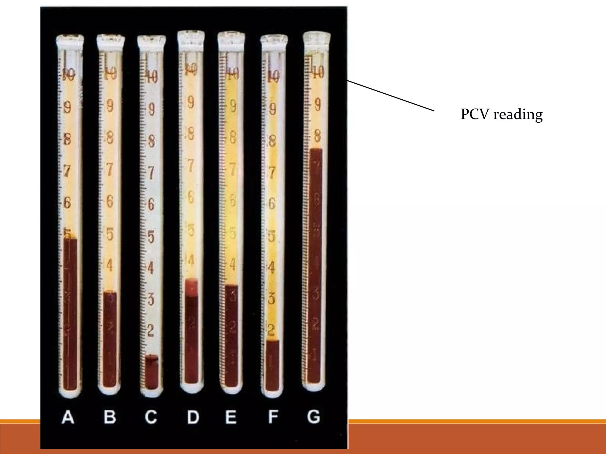 Esr, pcv, blood indices copy | PPT