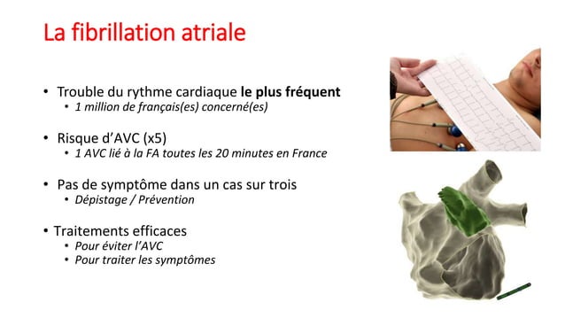 Fibrillation atriale | PPTX