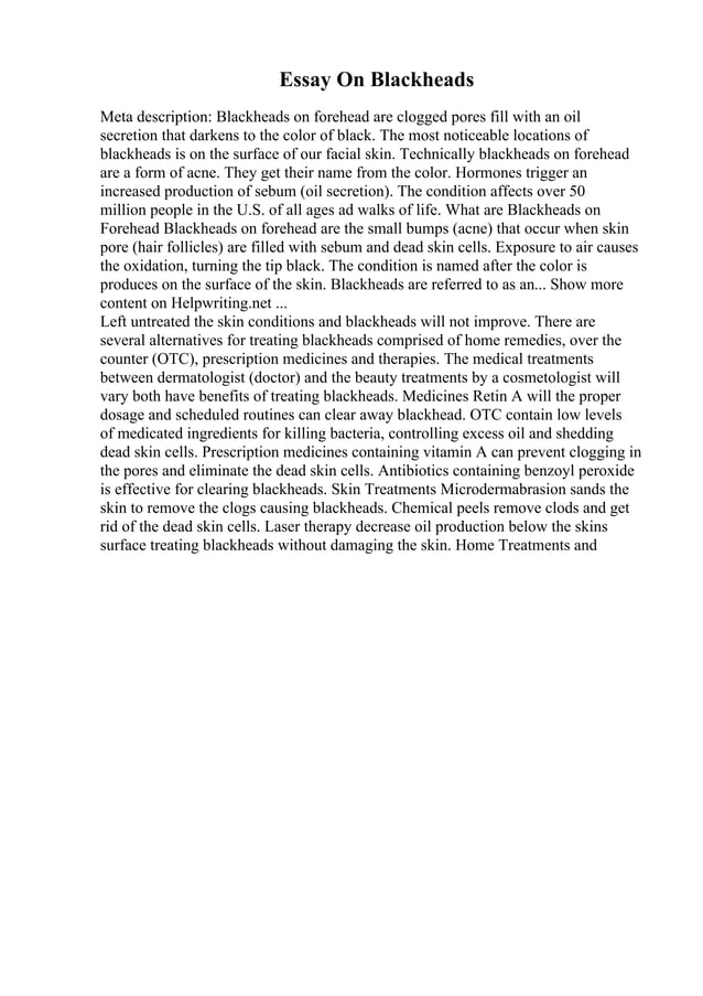 Essay Examples For Kids | PDF