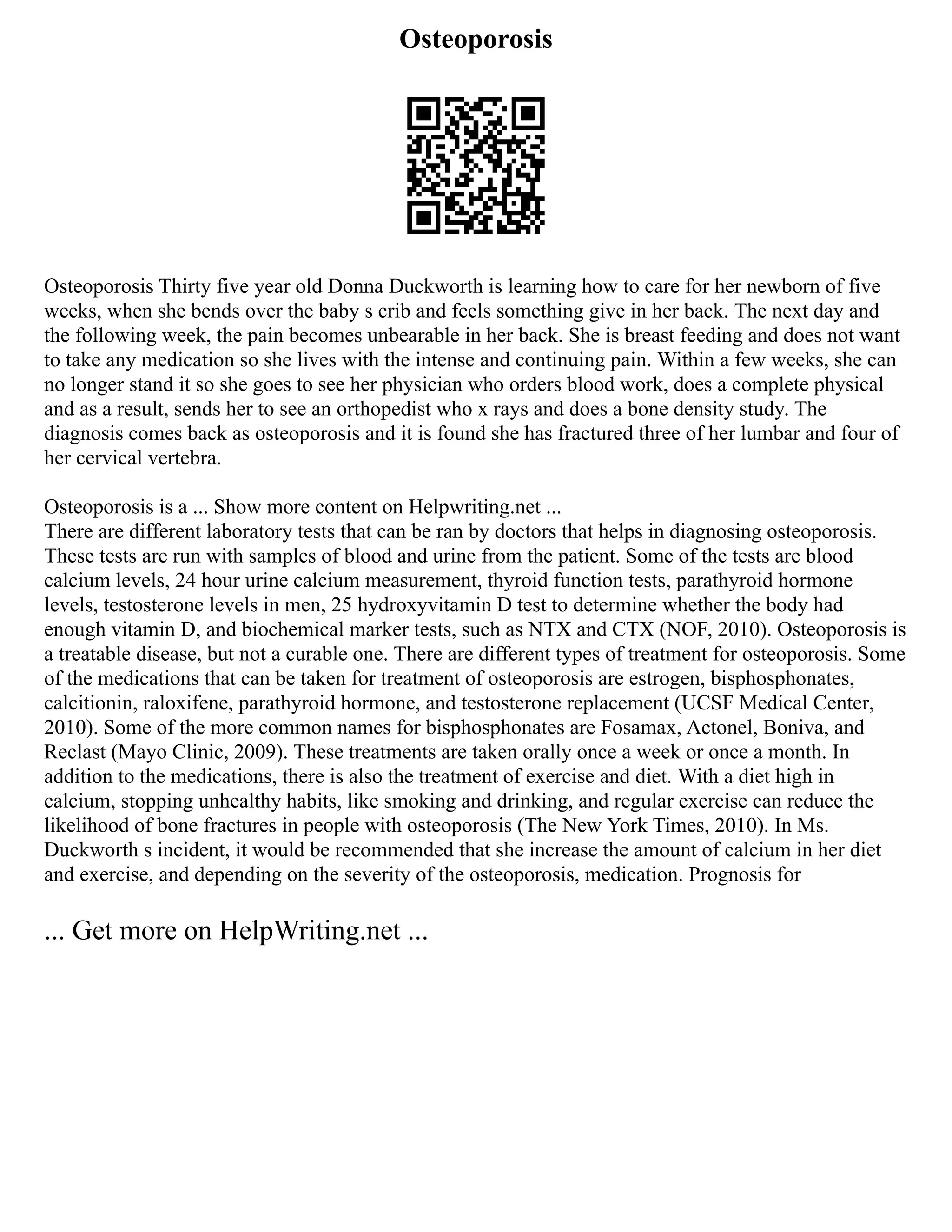 Essay Sequence Powerpoint Presentation Slide Template Prese | PDF