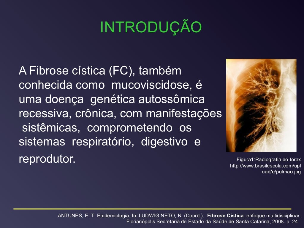 FIBROSE CÍSTICA