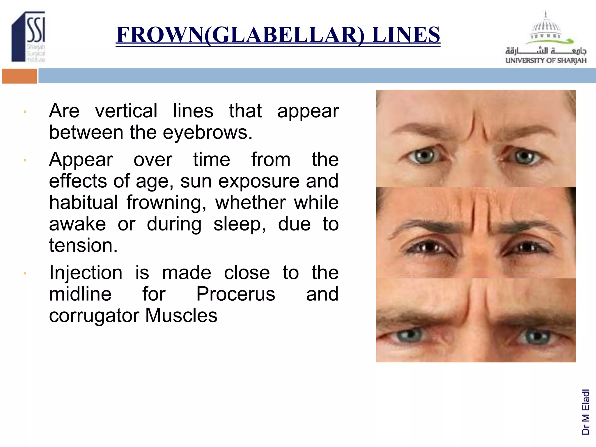 Essential anatomy for facial injections | PPTX