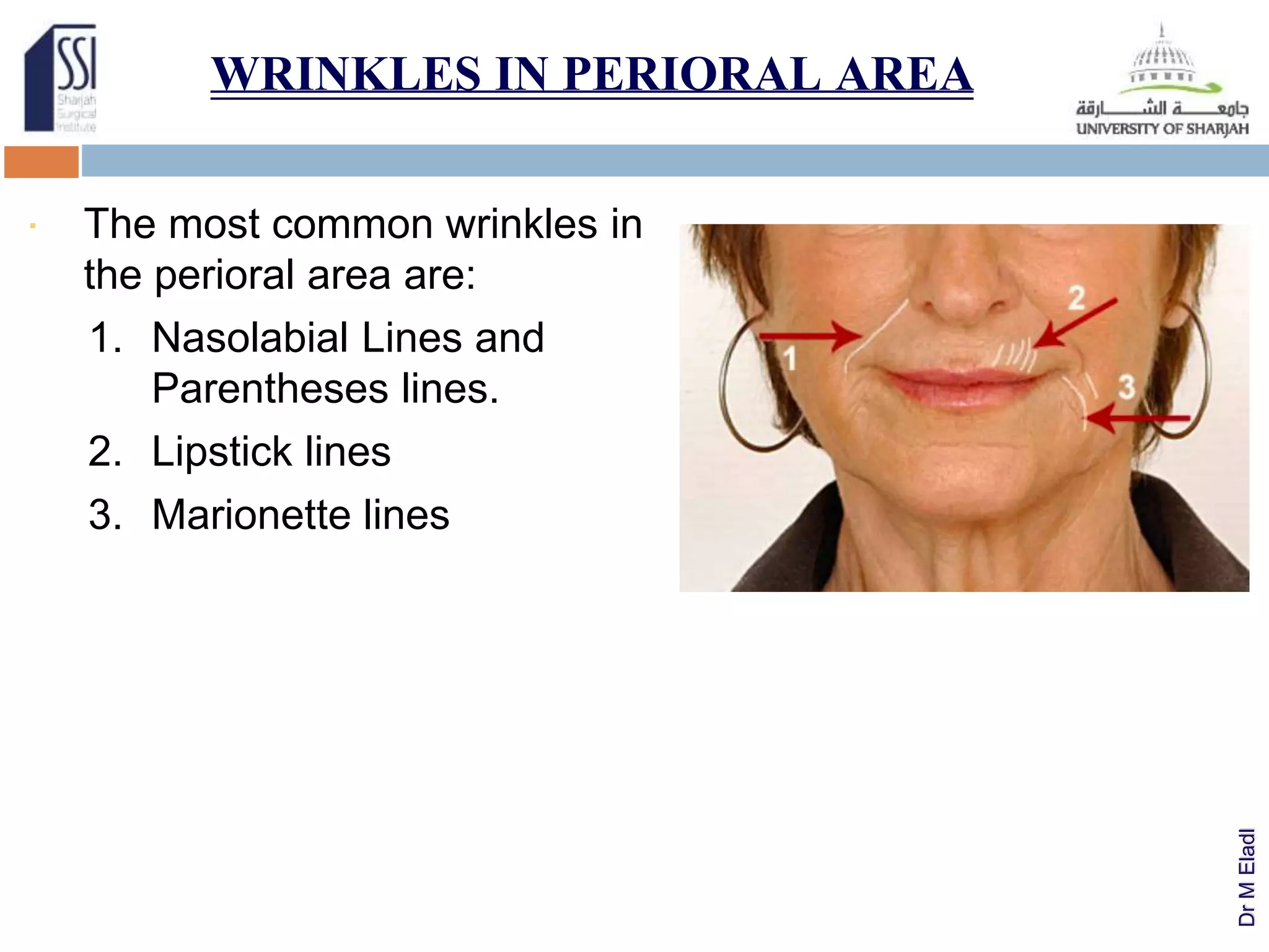 Essential anatomy for facial injections | PPTX