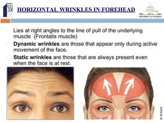 Essential anatomy for facial injections | PPTX