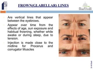 Essential anatomy for facial injections | PPTX