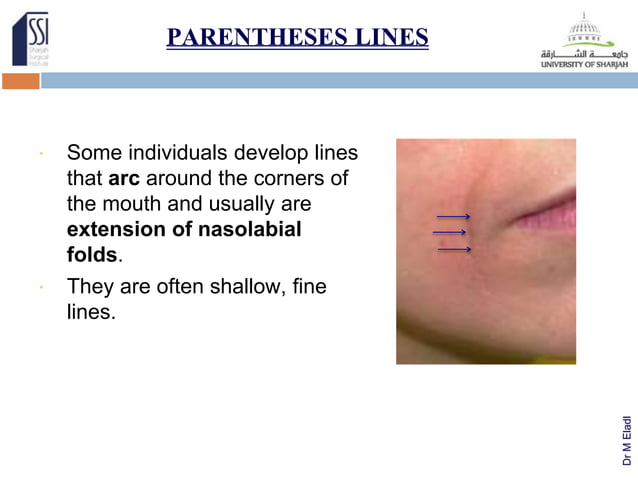 Essential anatomy for facial injections | PPTX