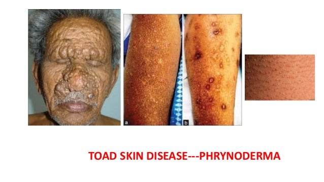 Chemistry of Essential Fatty Acids