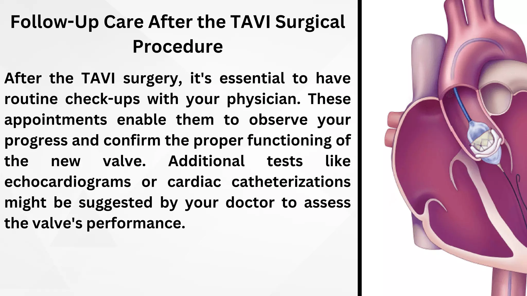 Essential Facts to Understand Before Undergoing a Transcatheter Aortic ...
