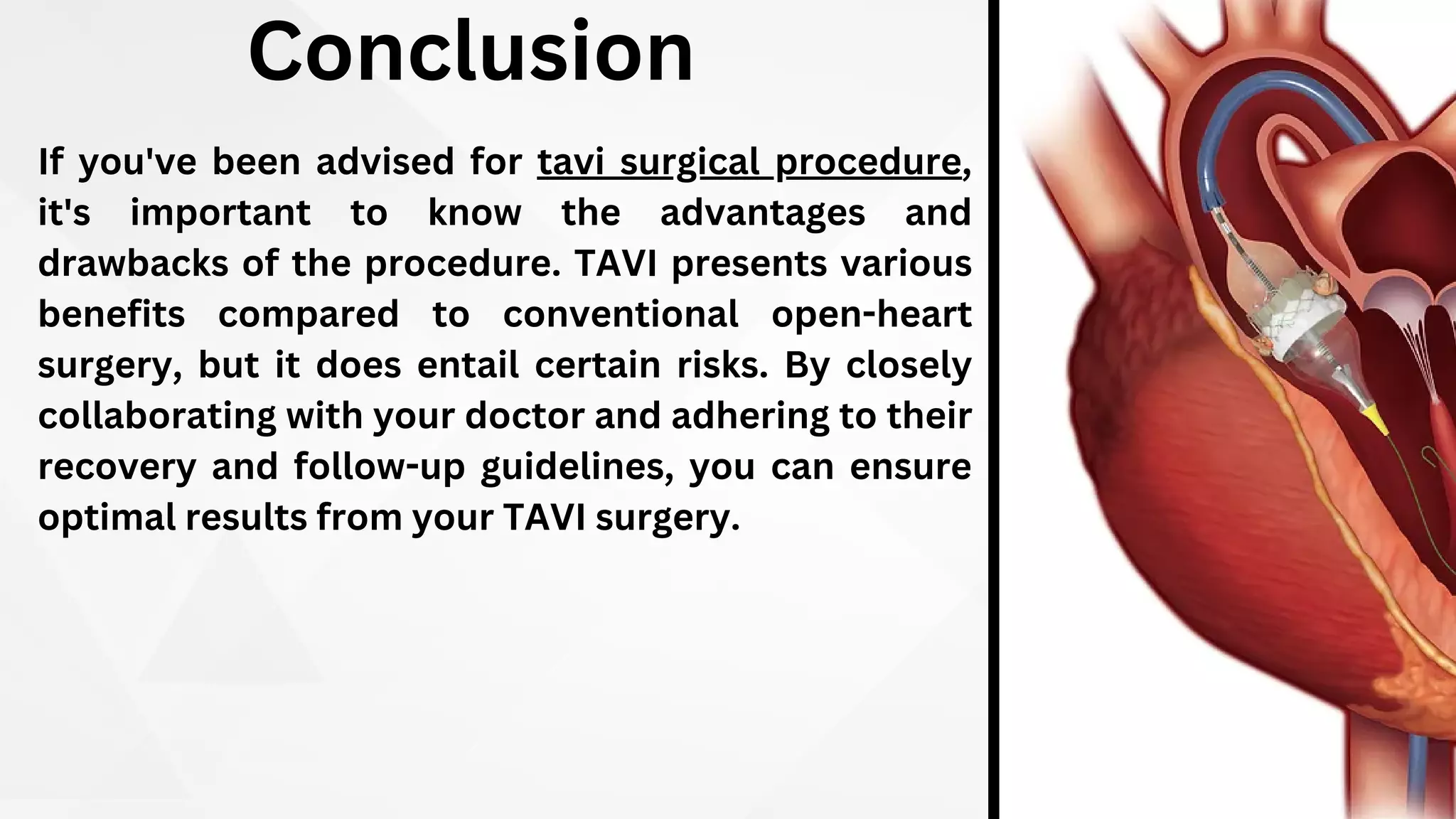 Essential Facts to Understand Before Undergoing a Transcatheter Aortic ...