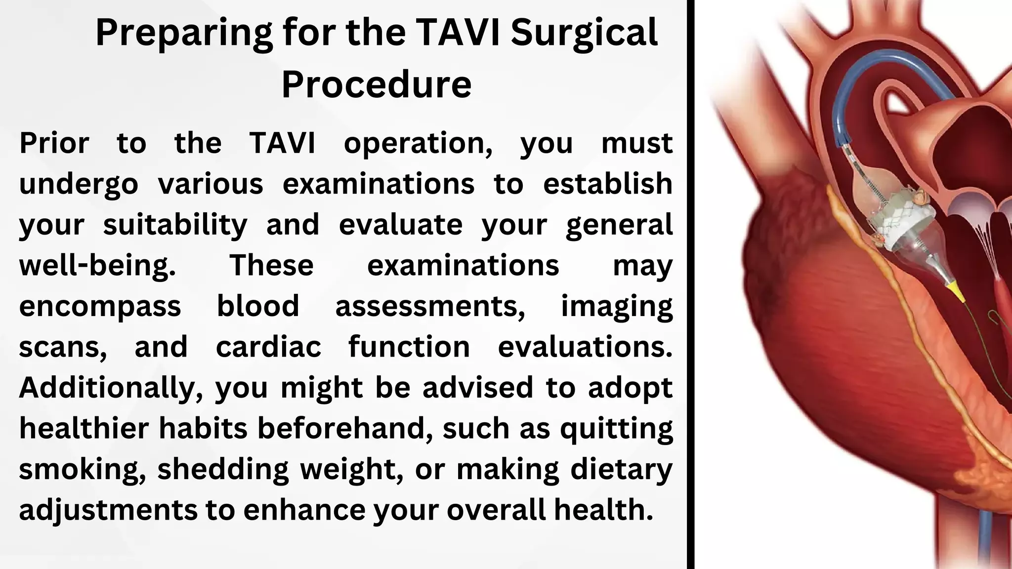 Essential Facts to Understand Before Undergoing a Transcatheter Aortic ...